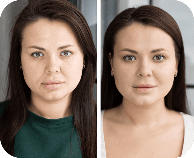 Luvly - #1 face yoga app | Practice facial fitness everywhere