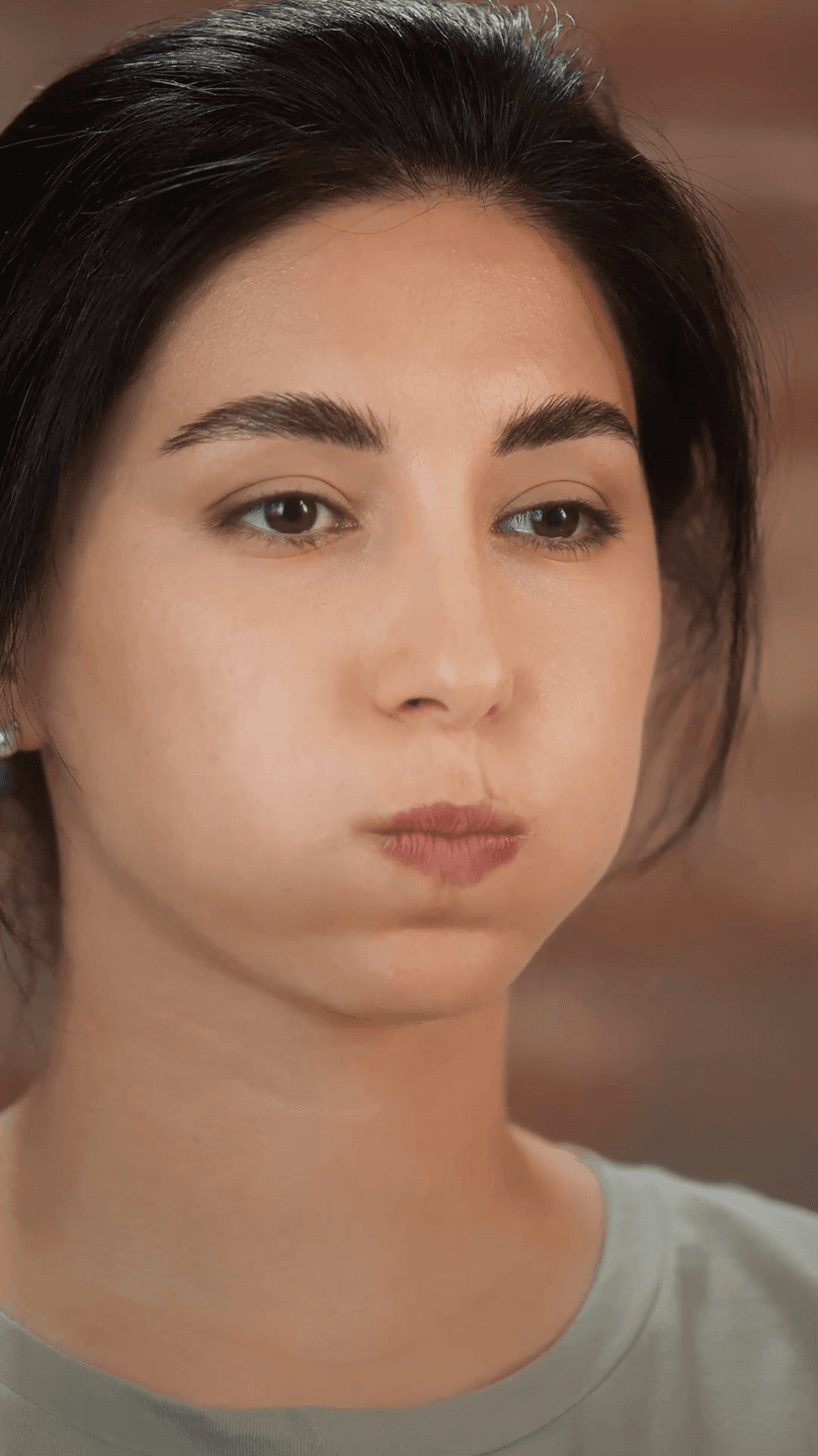 How to Fix Asymmetrical Face Naturally: How to Get a Symmetrical Face ...